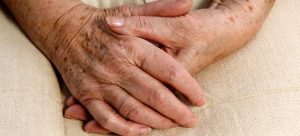 Altersflecken - Aussehen, Ursachen und Entfernung